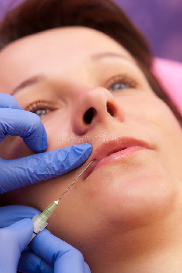 Face injection stock photo. Image of adult, woman, face - 26701782