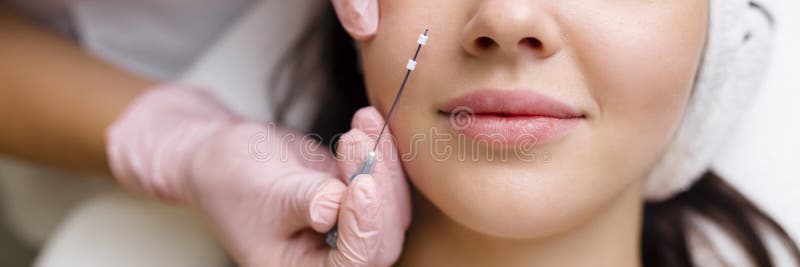 Face Lifting PDO Suture Operation. Innovative Technique of New Thread ...