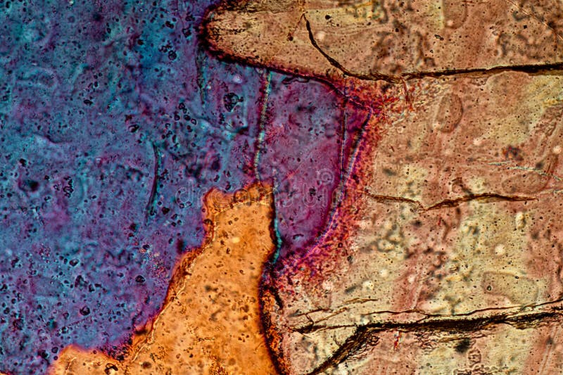 Face Like Structure in Thin Section Made by Microscope with Polarized ...