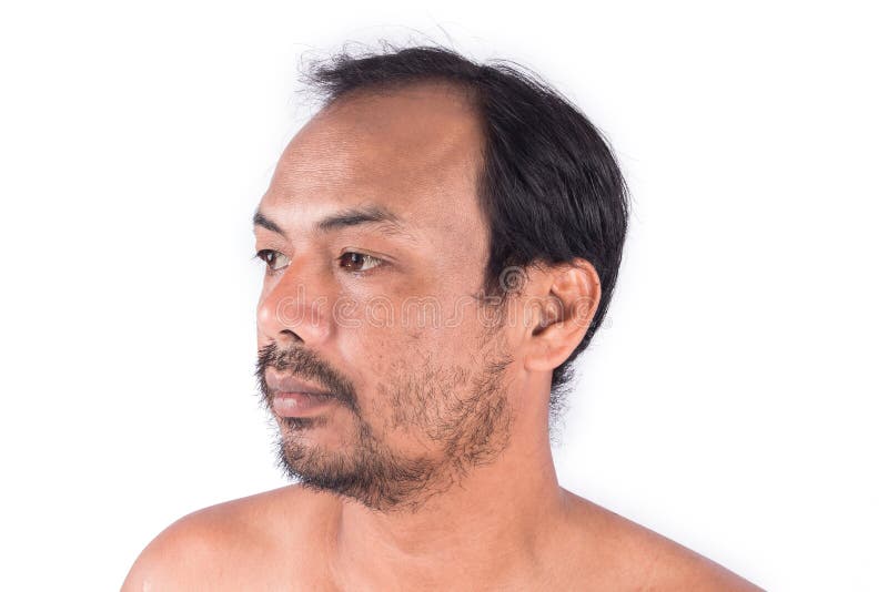 Face man bald head stock photo. Image of person, caucasian - 90190196