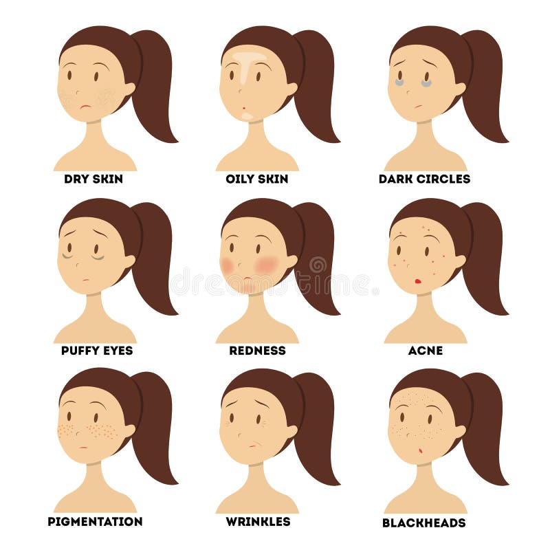 Face problems set. stock vector. Illustration of human - 103258358