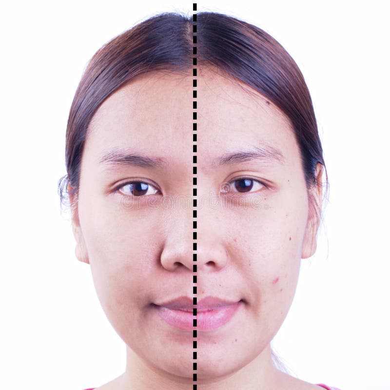 Face skin stock image. Image of beautiful, beauty, caucasian - 68552037