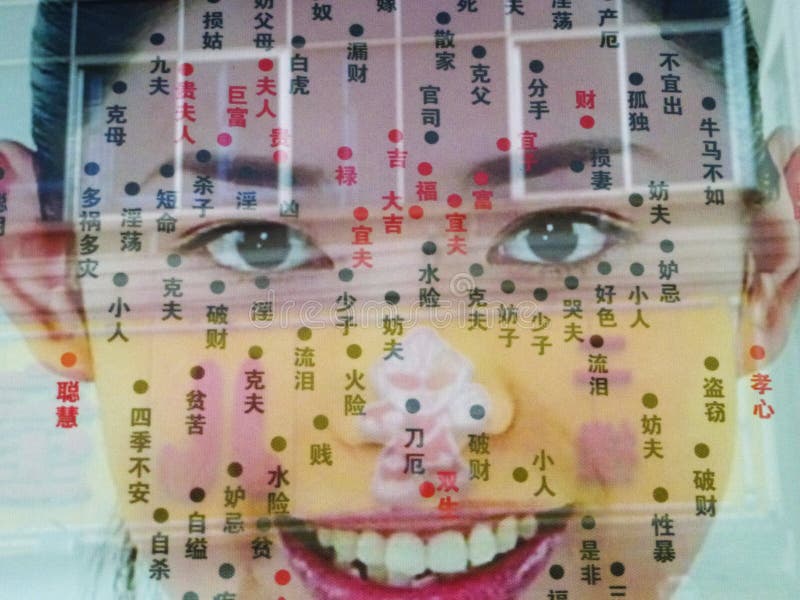 Facial nevus editorial stock image. Image of close, asia - 90403409