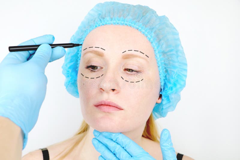 Facial Plastic Surgery or Facelift, Facelift, Face Correction. a ...