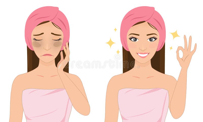 Melasma Stock Illustrations – 291 Melasma Stock Illustrations, Vectors ...