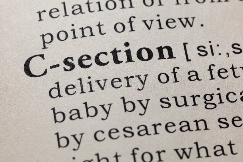 Definition of C-section stock photo. Image of close - 124010074