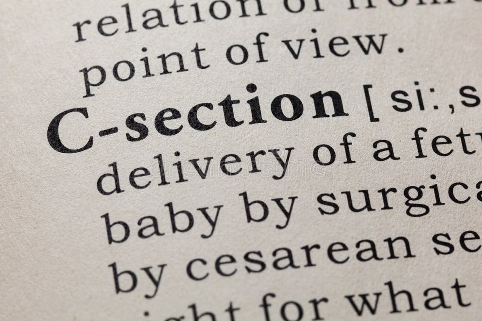 Definition of C-section stock photo. Image of close - 124010074