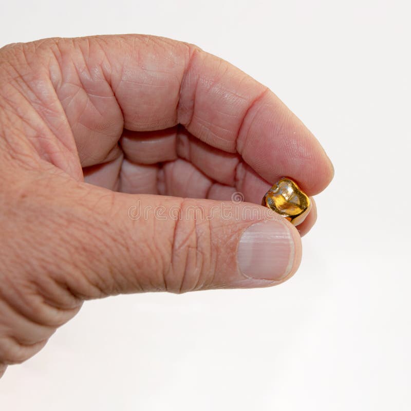 A Fallen Gold Tooth in the Hand of an Elderly Man.. Stock Image - Image ...