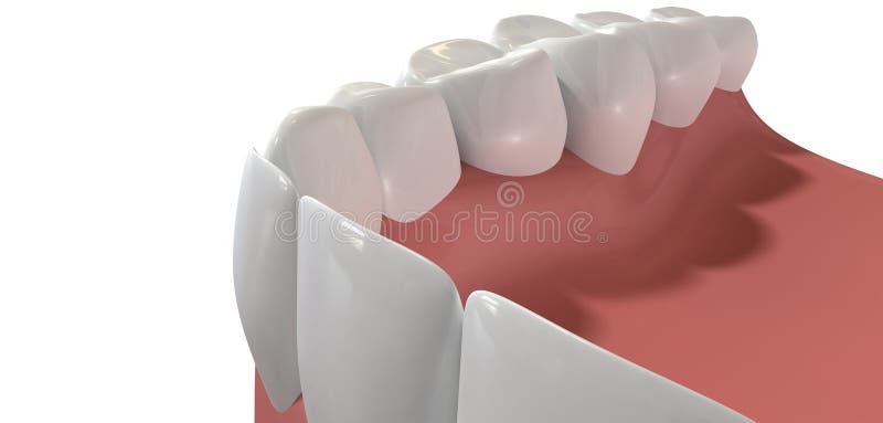 False Human Teeth Extreme Closeup Stock Illustration - Illustration of ...