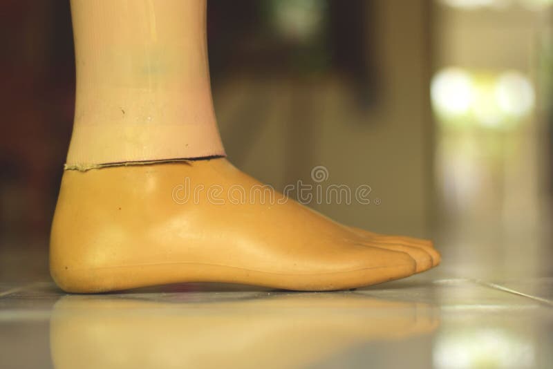 An Old Man with a Leg Amputation Below the Knee Was in Pain. Stock ...