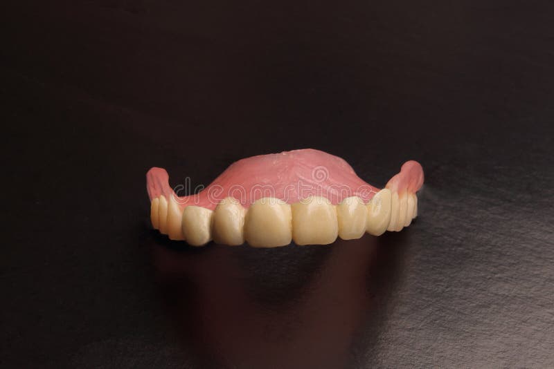 Gold Teeth Dentures Black Background Stock Photos - Free & Royalty-Free ...