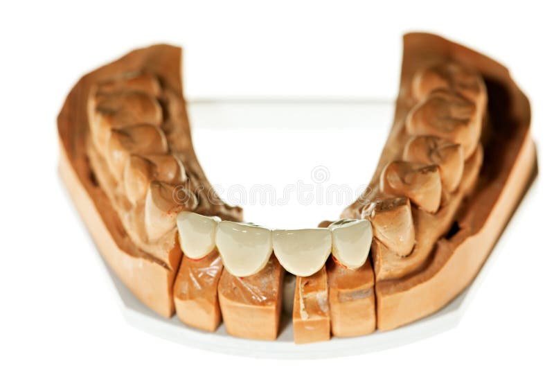 Teeth Prosthesis in Human Hand Stock Image - Image of fake ...