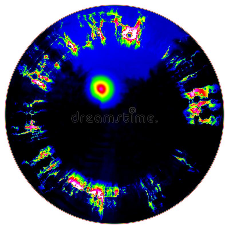 Fantastic Infrared Scan of Black Eye Iris, Light Reflection. Stock ...