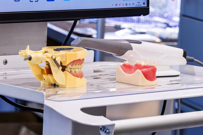 Fast Intraoral Scanner in Dentistry with Advanced Artificial ...