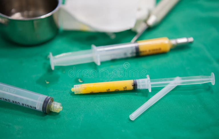 Breast Fat Grafting Stock Photos - Free & Royalty-Free Stock Photos ...