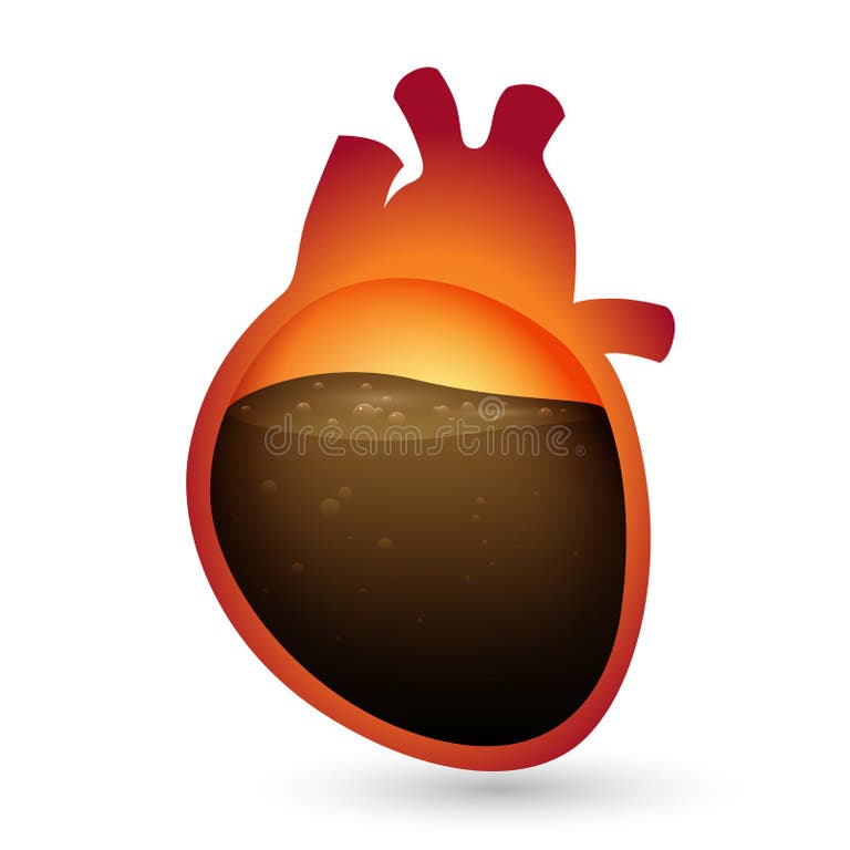 Fat in the Heart stock vector. Illustration of artery - 98846545