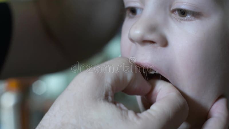 Boy Shaking Wobbly Milk Tooth in Open Mouth before it Changes To the ...