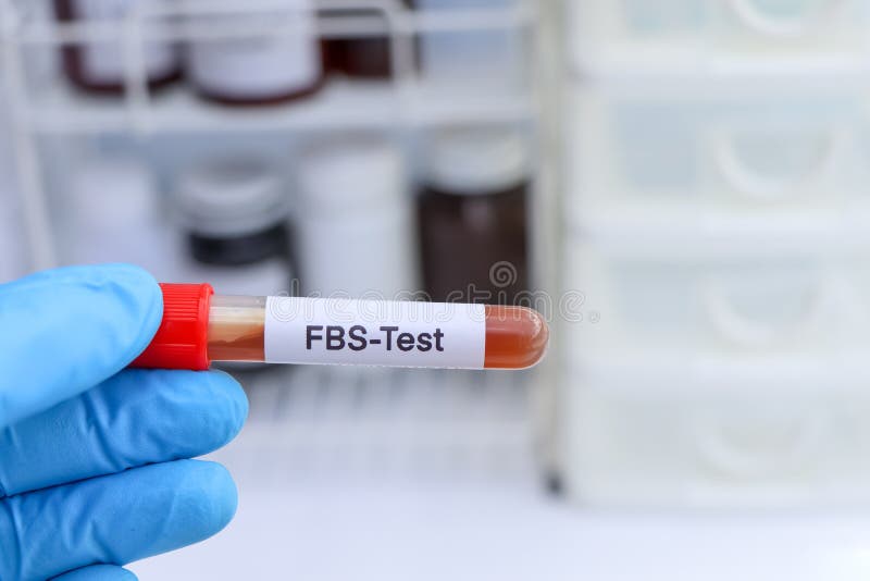 FBS Test To Look for Abnormalities from Blood Stock Photo - Image of ...