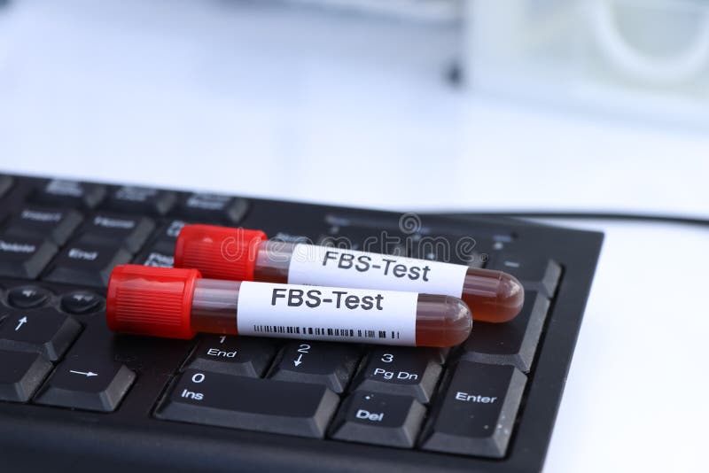 FBS Test To Look for Abnormalities from Blood Stock Image - Image of ...