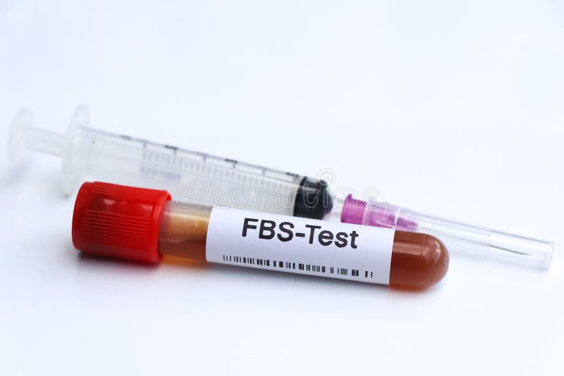 FBS Test To Look for Abnormalities from Blood Stock Photo - Image of ...
