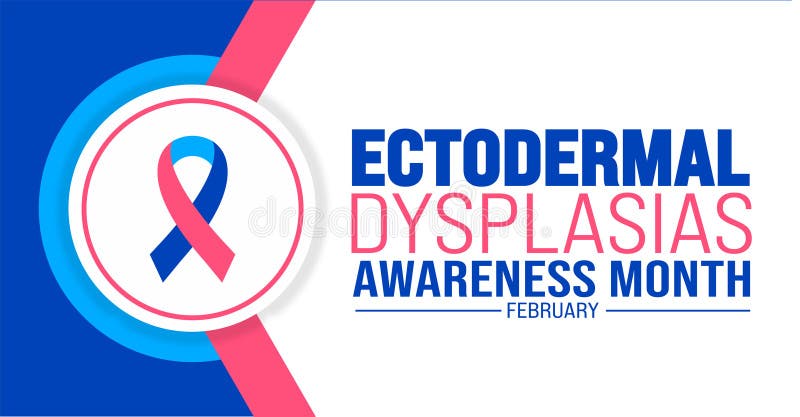 Ectodermal Dysplasia Stock Illustrations – 12 Ectodermal Dysplasia ...