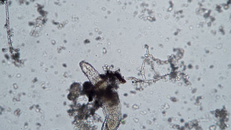 Worm Under Microscope Real