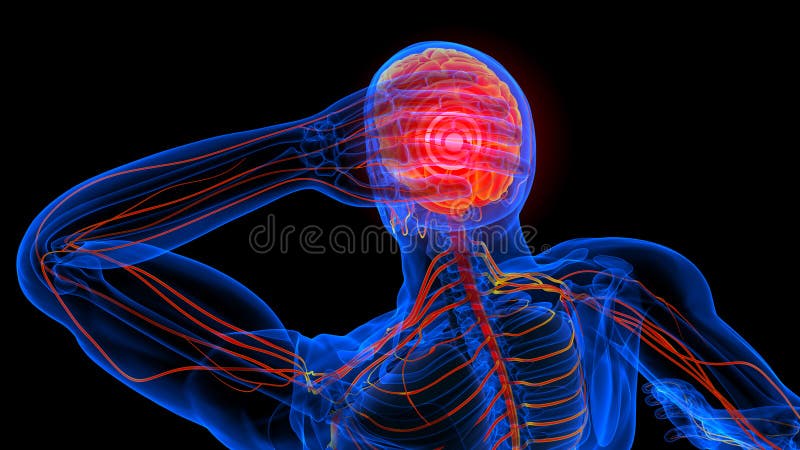 Feeling Headache Anatomy for Medical Concept 3D Rendering Stock ...