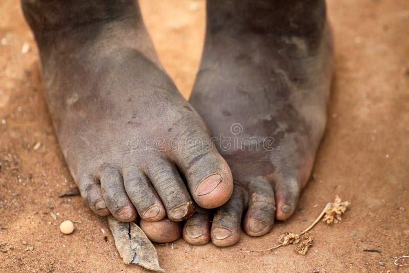 8,170 African Feet Stock Photos - Free & Royalty-Free Stock Photos from ...