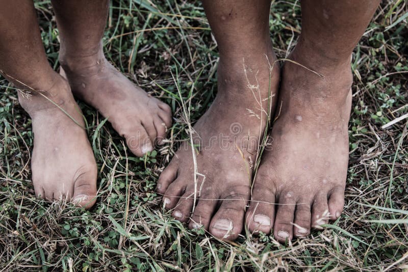 The Feet of Boy on the Grass Stock Image - Image of grass, problems ...