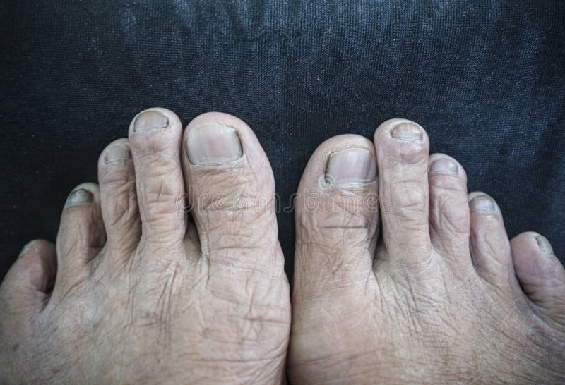 Feet of an elderly person stock image. Image of pedicure - 402853807