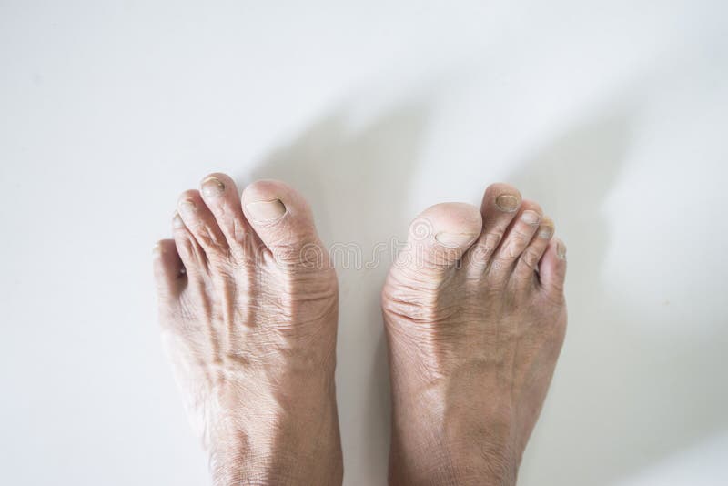 496 Old Man Toes Stock Photos - Free & Royalty-Free Stock Photos from ...