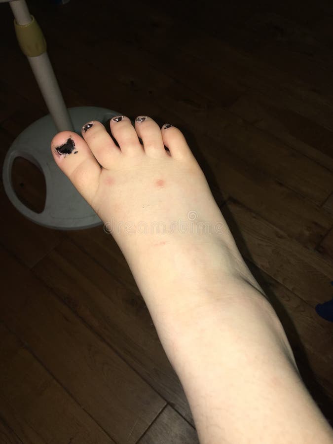 Feet pic stock photo. Image of nice, feet, toes - 167937074