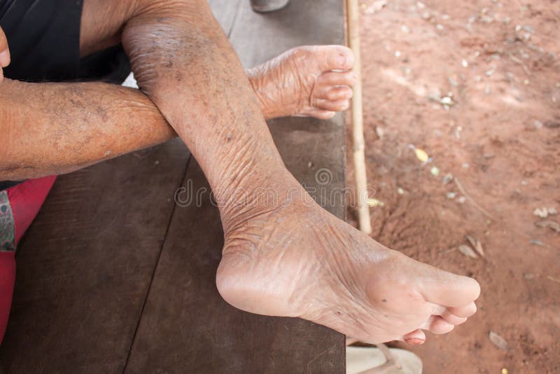 25+ Feet man old Free Stock Photos - StockFreeImages