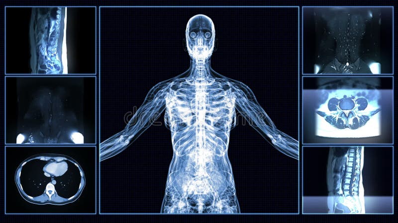 Female Body MRI Scan stock video. Video of healthcare - 71779431