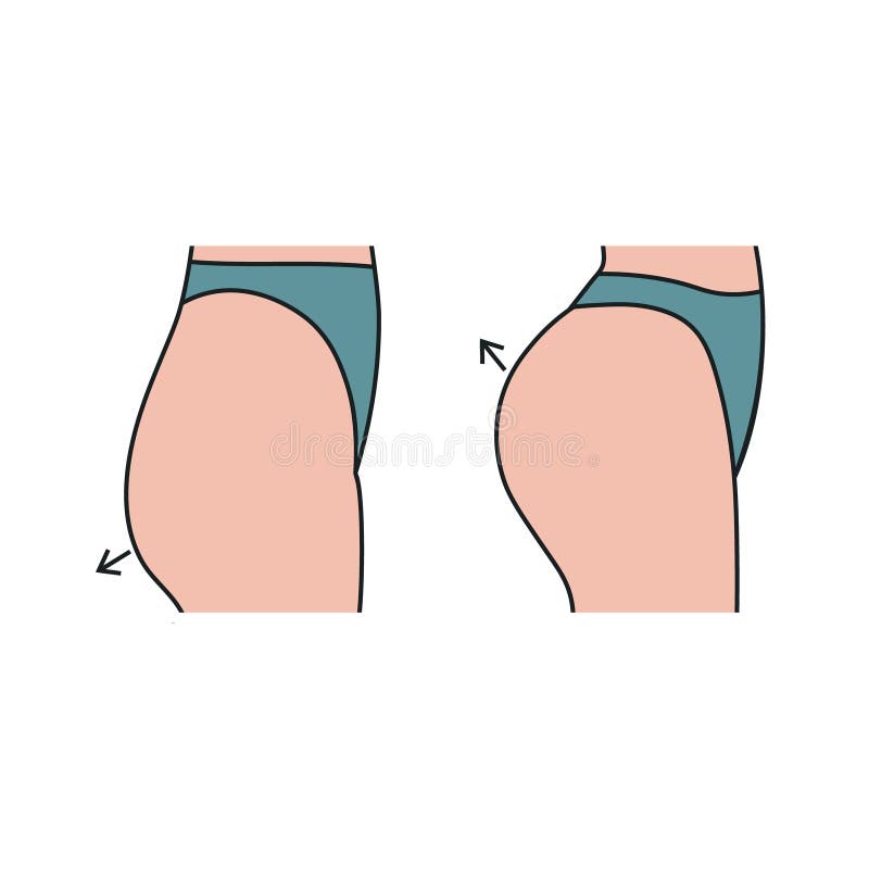 Female Buttocks before and after. Stock Vector - Illustration of symbol, shape: 222080414