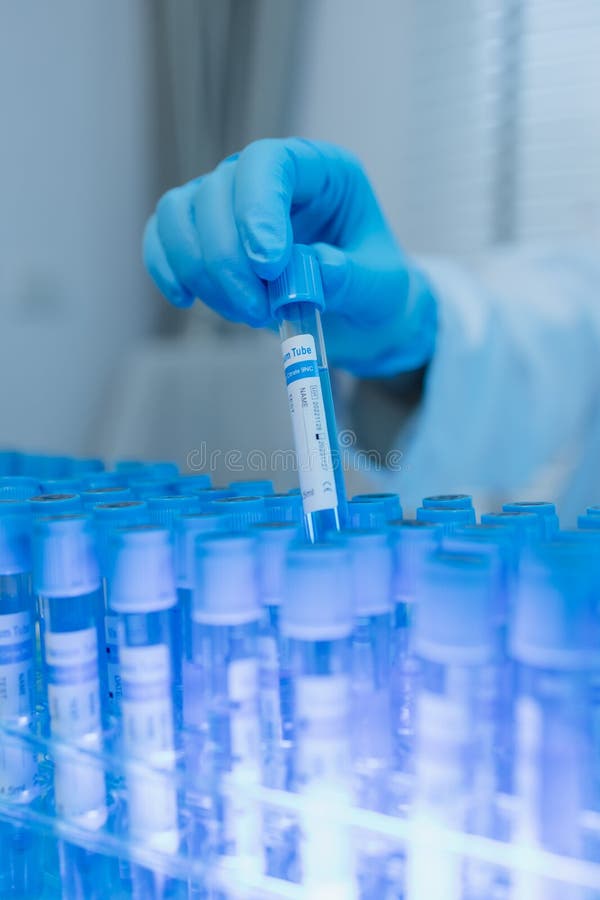 A Female Chemist is Testing Various Liquid Compounds in a Lab, a ...