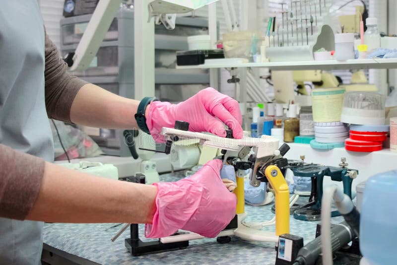 A Female Prosthetist Wraps a Plaster Cast Around the Leg Stump & X28 ...