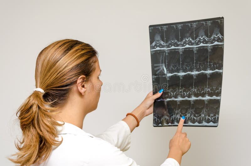 Female Doctor Checking an MR Stock Image - Image of imaging, insurance ...