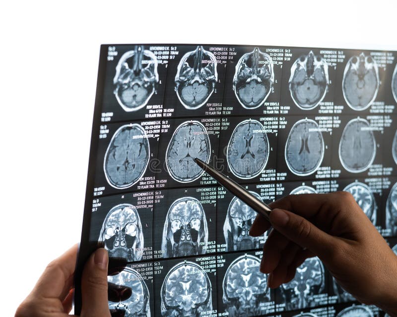 A Female Doctor Examines an MRI Scan of the Brain. Stock Photo - Image ...