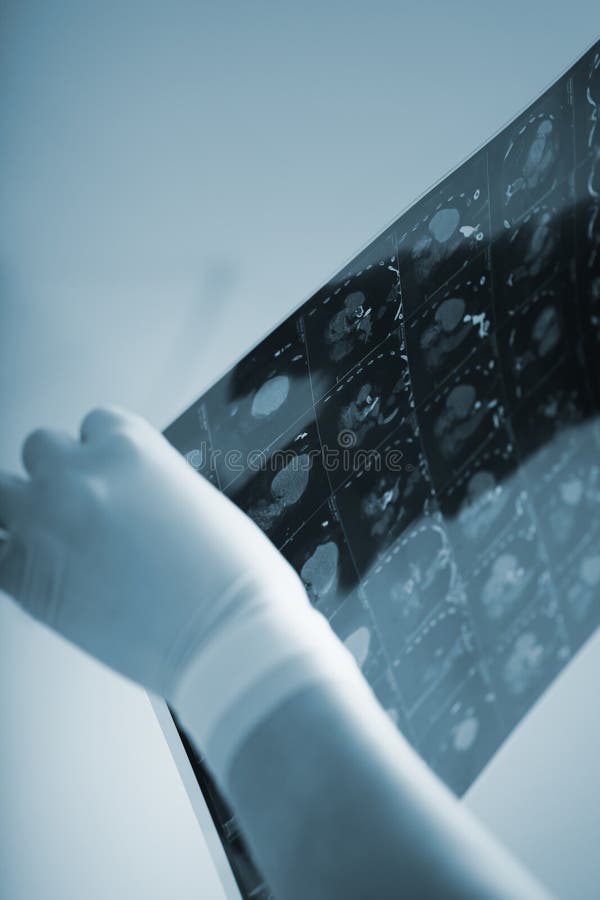 Female Doctor Holding the CT Scan in the Gloved Hand Stock Photo ...