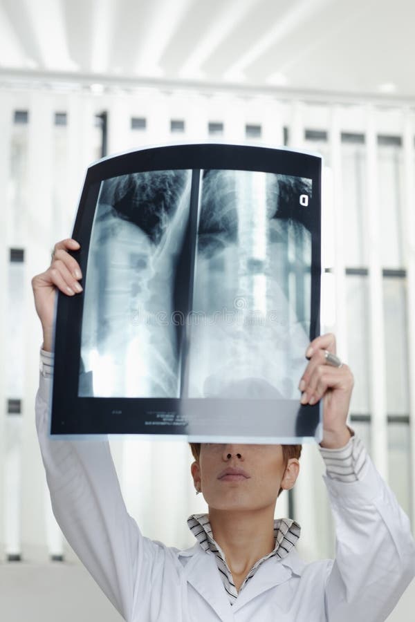Chest Xray stock image. Image of tach, spine, hospital, chest - 75599