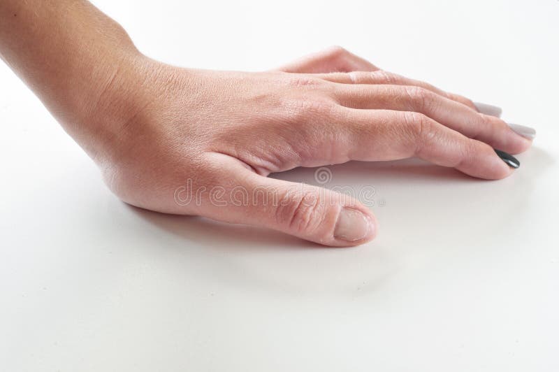 Chewed fingernail stock image. Image of chewed, compare - 49771599