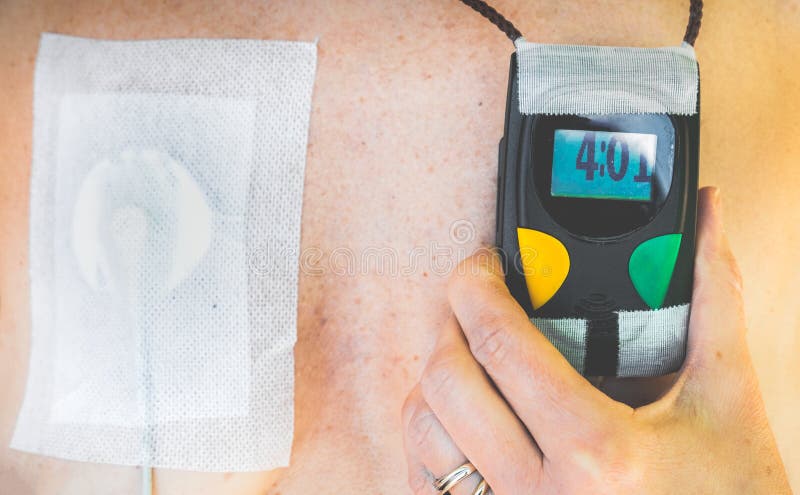 Hand Holter Ecg Device Patch Stock Photo - Image of hold, measurement ...