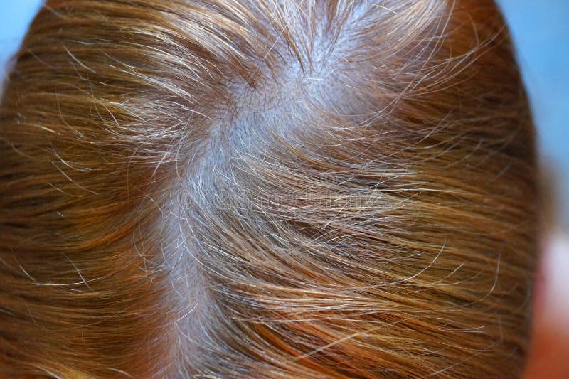 2,751 Human Head Top View Stock Photos - Free & Royalty-Free Stock ...