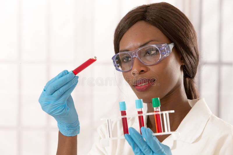 Female Lab Assistant Studying Blood Sample for Analysis Stock Image ...