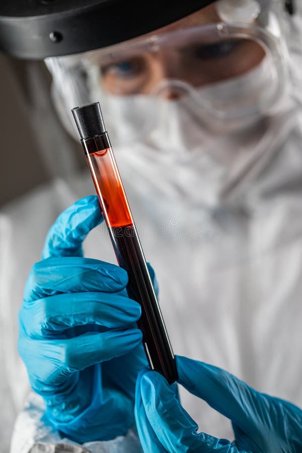 Female Lab Worker Holds Test Tube of Blood for Testing Stock Photo ...