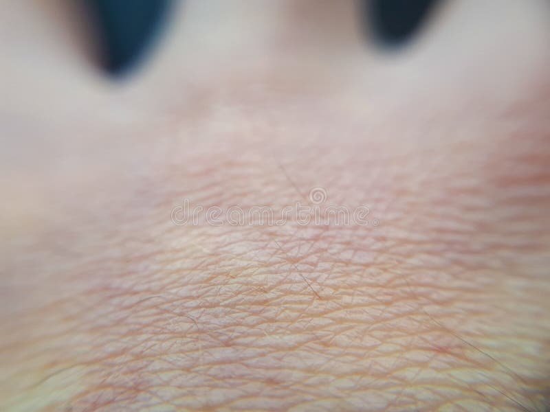 Macro Skin Of Human Hand.Medicine And Dermatology Concept. Details Of ...