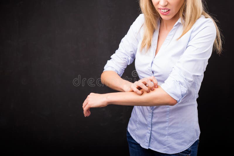 Woman scratching her arm stock image. Image of pain, intense - 37662169