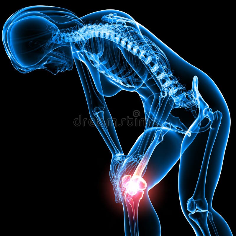 Female Skeleton with Knee Pain Stock Illustration - Illustration of ...