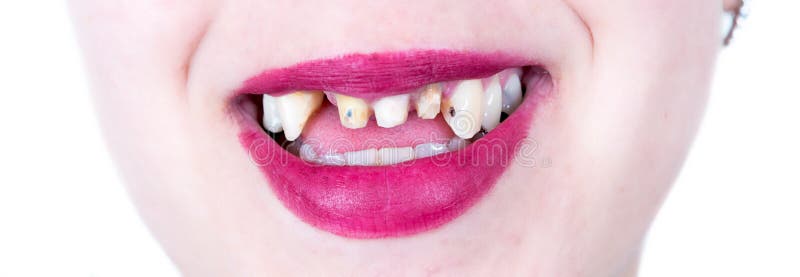 Female smile with no teeth stock photo. Image of girl - 73589920